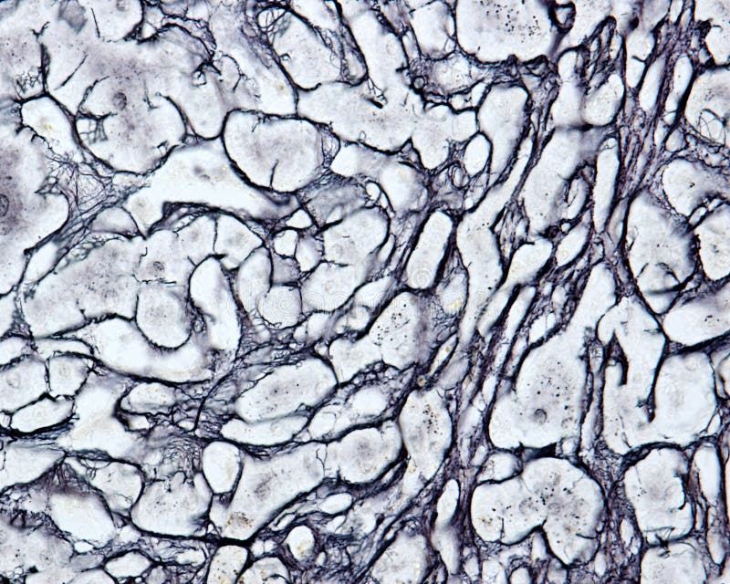 Histology Liver Reticular Stock Photos - Free & Royalty-Free Stock ...