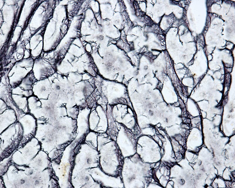 Histology Liver Reticular Stock Photos - Free & Royalty-Free Stock ...