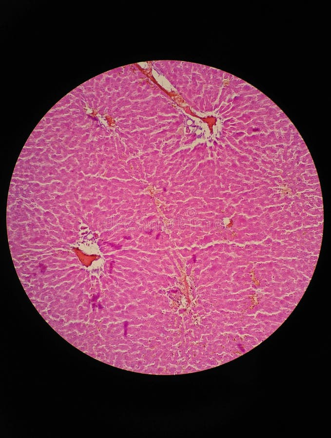 Human Liver Tissue Under the Microscope View. Stock Image - Image of ...