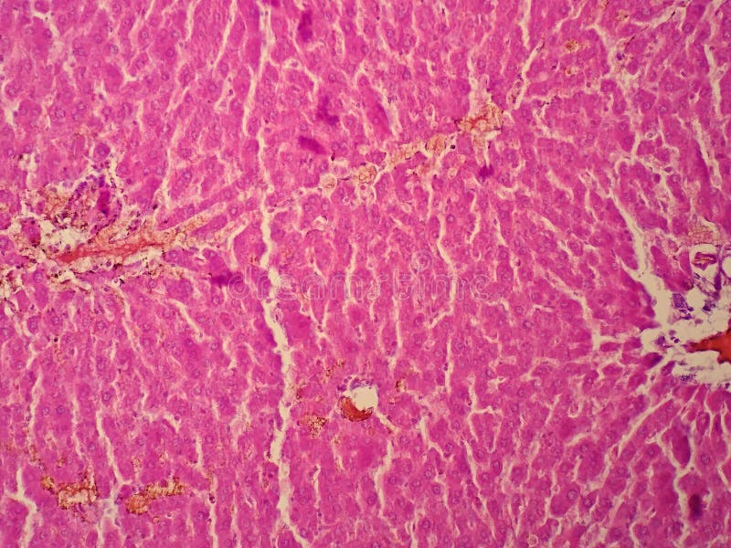 Human Liver Tissue Under the Microscope View. Stock Image - Image of ...