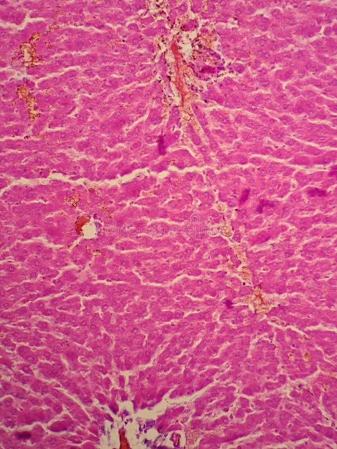 Human Liver Tissue Under the Microscope View. Stock Image - Image of ...