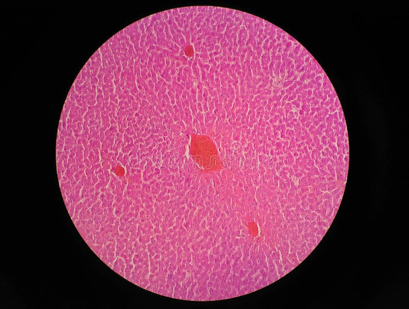 Human liver tissue stock photo. Image of adherent, human - 89484510