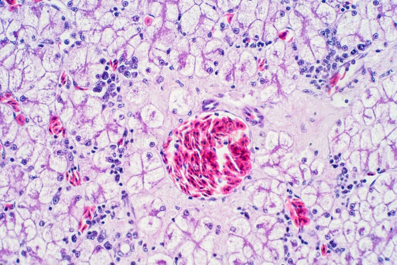 Human Liver Tissue Under the Microscope View Stock Image - Image of ...