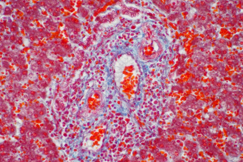 Human Liver Tissue Under the Microscope View. Stock Image - Image of ...