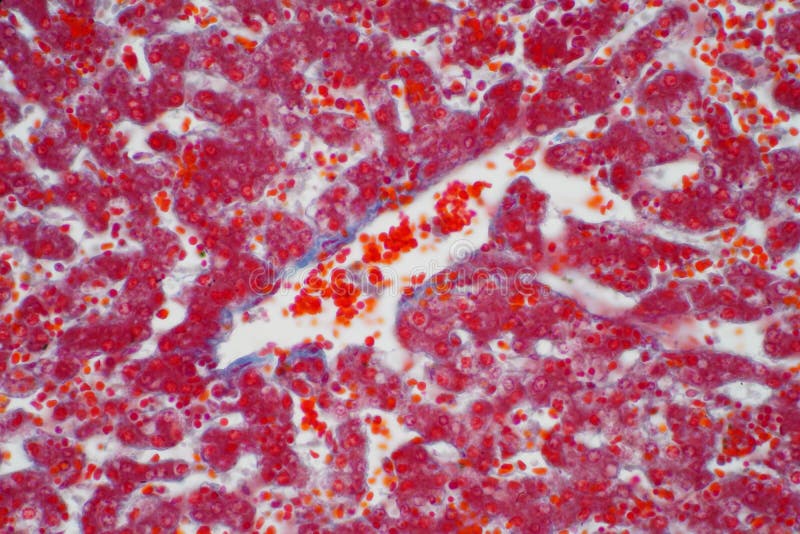 Human Liver Tissue Under Microscope View for Education Histology Stock ...