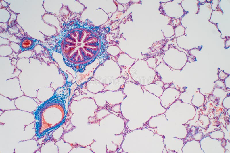 Human Lung Tissue Under Microscope, the Lungs is Organs of the ...