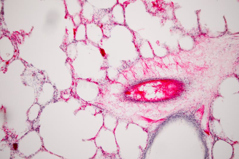 Human Lung Tissue Under Microscope, the Lungs is Organs of the ...