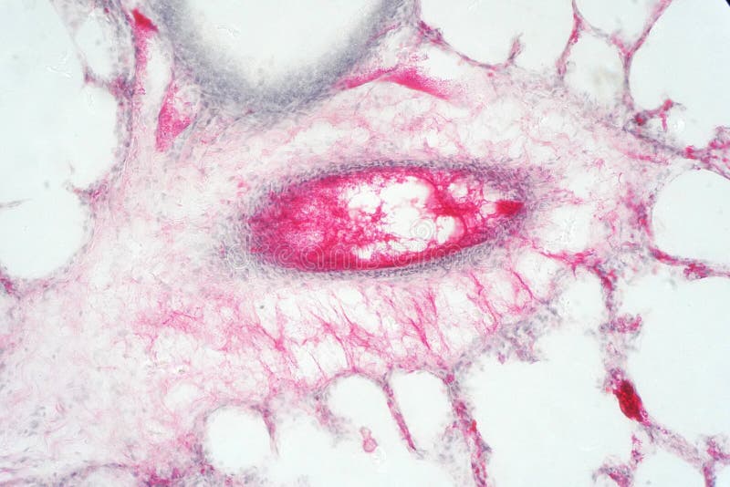 Human Lung Tissue Under Microscope View. Stock Image - Image of ...
