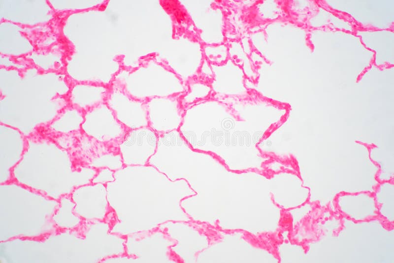 Human Lung Tissue Under Microscope View Stock Image - Image of breathe ...