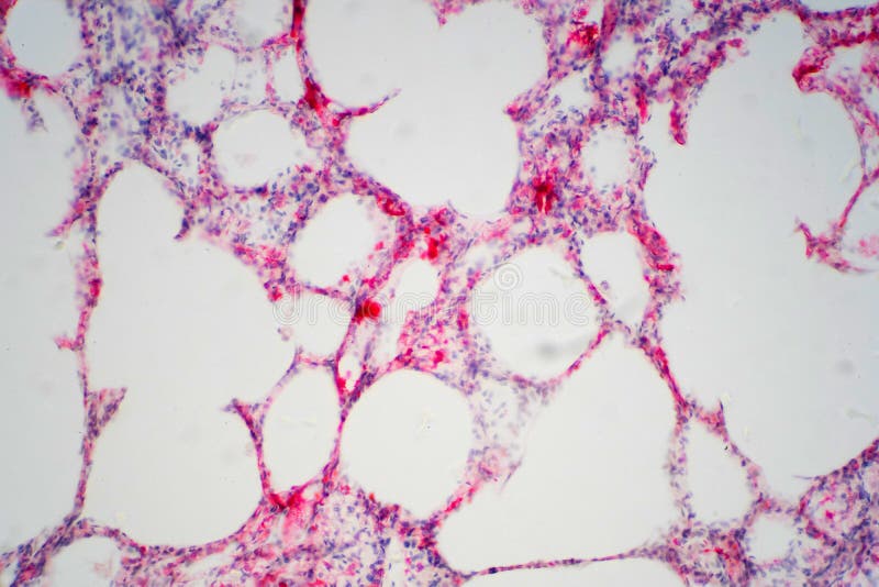 Human Lung Tissue Under Microscope View Stock Image - Image of ...