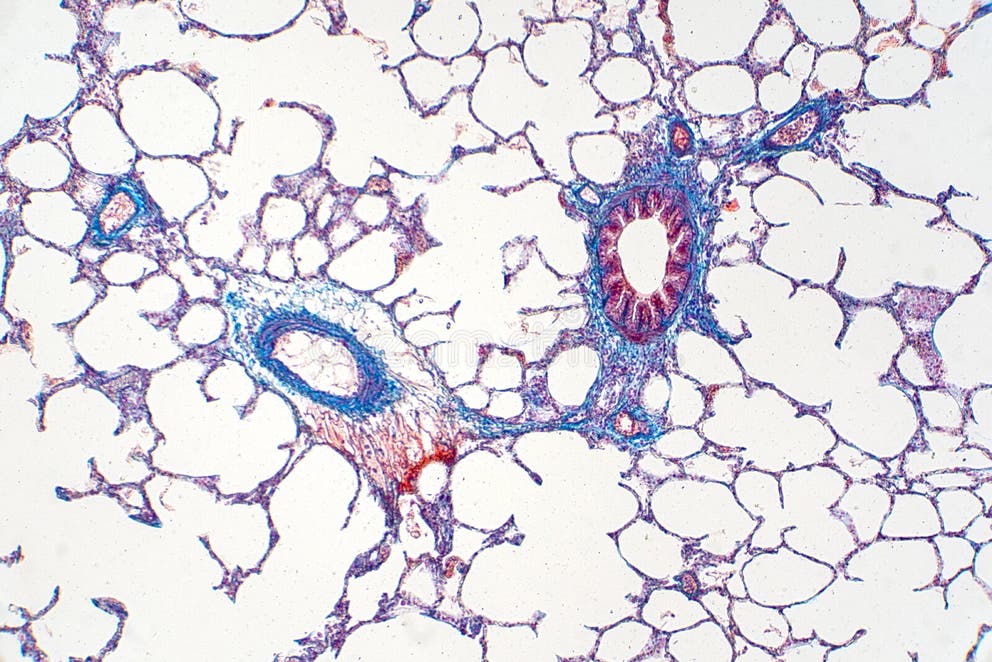 Human Lung Tissue Under Microscope View Stock Image - Image of ...