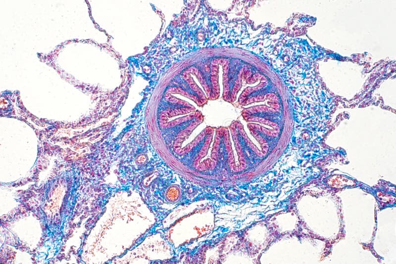 Human Lung Tissue Under Microscope View Stock Photo - Image of medical ...