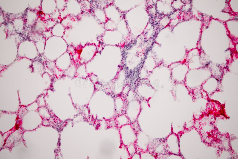 Human Lung Tissue Under Microscope View for Education Histology. Stock ...