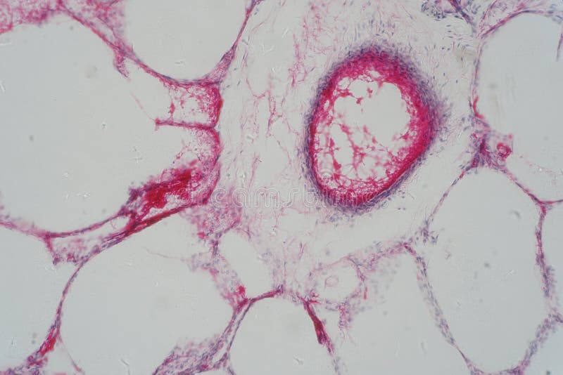 Human Lung Tissue Under Microscope View. Stock Image - Image of organ ...