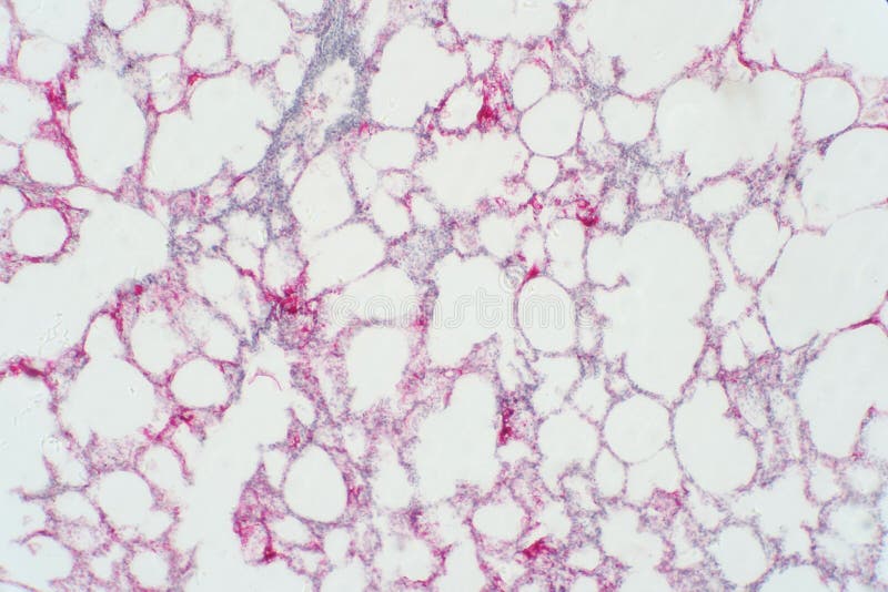 Human Lung Tissue Under Microscope View for Education Histology. Stock ...