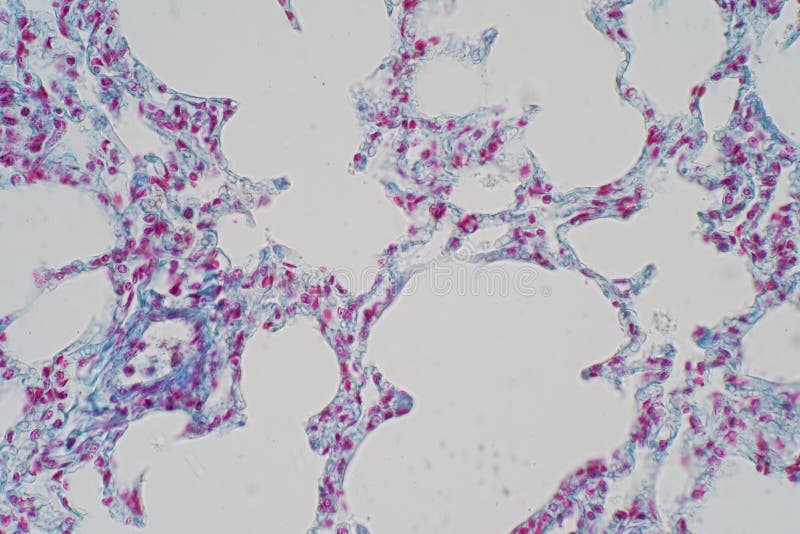 Human Lung Tissue Under Microscope View Stock Photo - Image of body ...