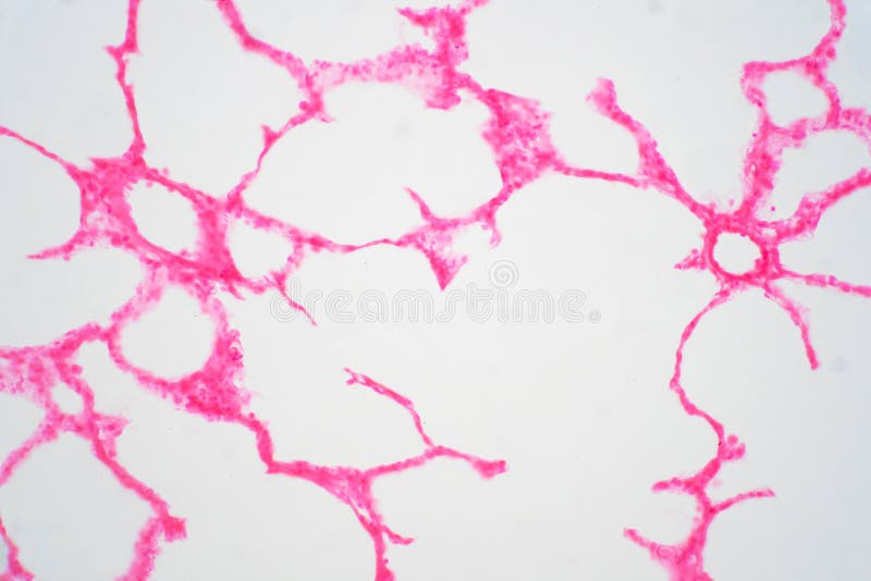 Human Lung Tissue Under Microscope View Stock Photo - Image of cell ...