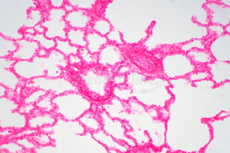 Human Lung Tissue Under Microscope View Stock Image - Image of medicine ...
