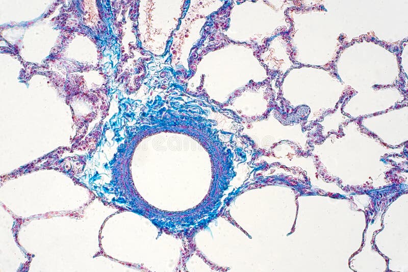 Human Lung Tissue Under Microscope View Stock Image - Image of gullet ...