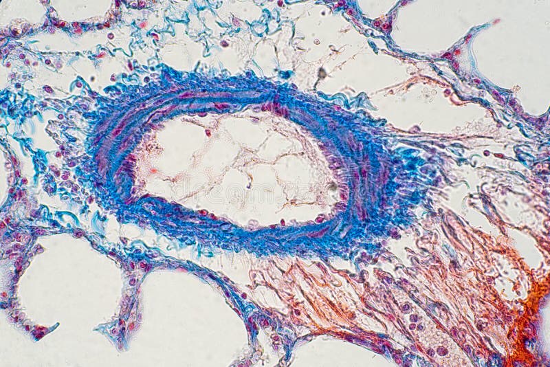 Human Lung Tissue Under Microscope View Stock Image - Image of anatomy ...