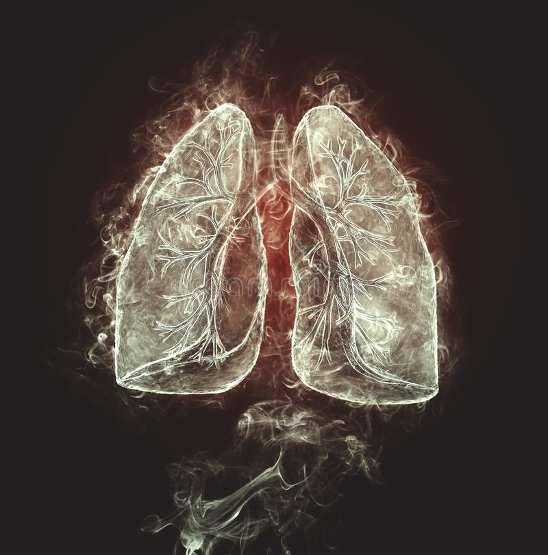 Lung Cancer Illustrated As Smoke Shaped As Lungs Stock Illustration ...