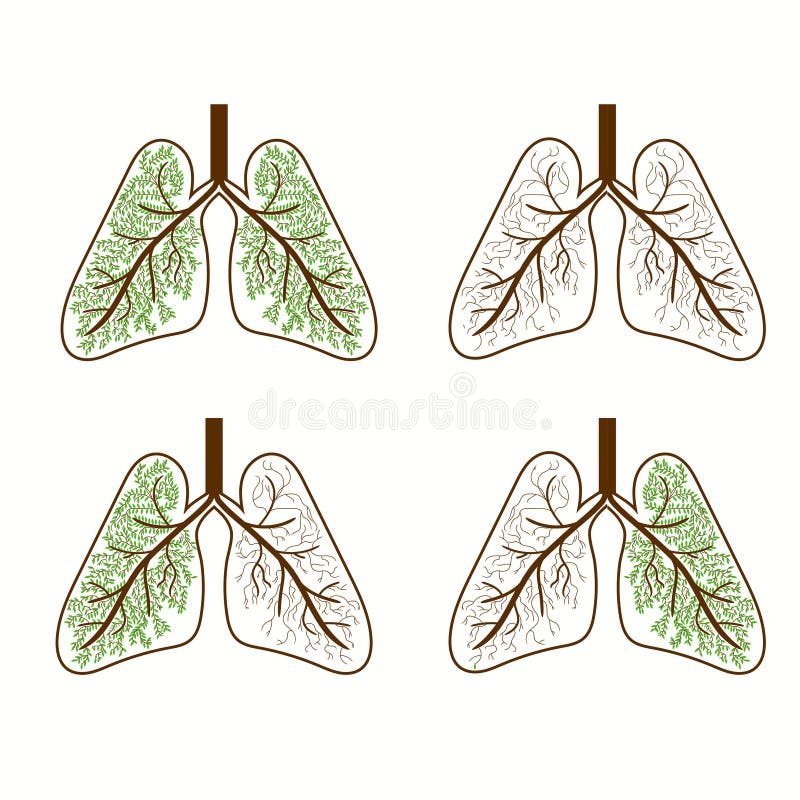 Human Lungs Tree Vector Stock Illustrations – 601 Human Lungs Tree ...