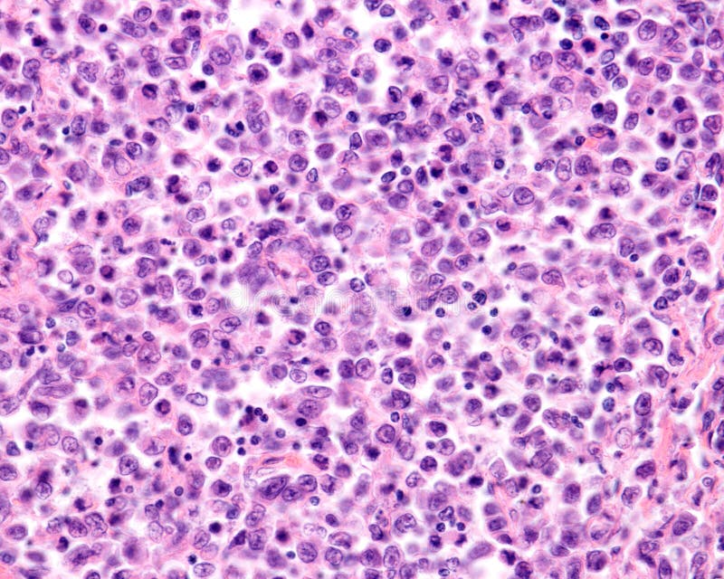 104 Lymph Node Structure Stock Photos - Free & Royalty-Free Stock ...