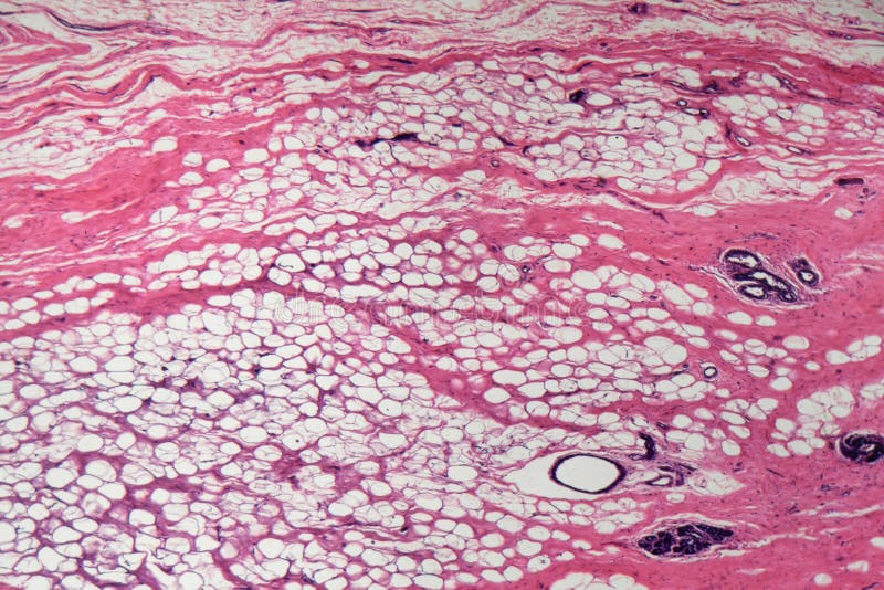 Human Mammary Gland Cells Under the Microscope Stock Photo - Image of ...