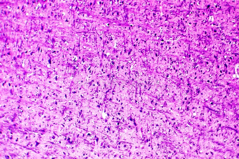 Human medulla oblongata stock image. Image of ultrastructure - 103927313