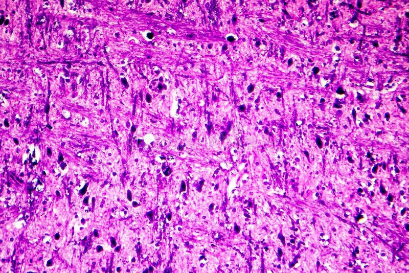Human medulla oblongata stock image. Image of ultrastructure - 103927313