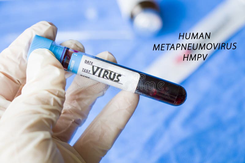 Human Metapneumovirus, HMPV Virus Stock Photo - Image of elements ...