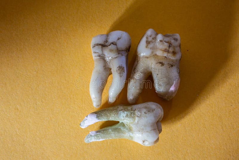 Human Molars With Tooth Roots Stock Photo - Image of bite, white: 191660006