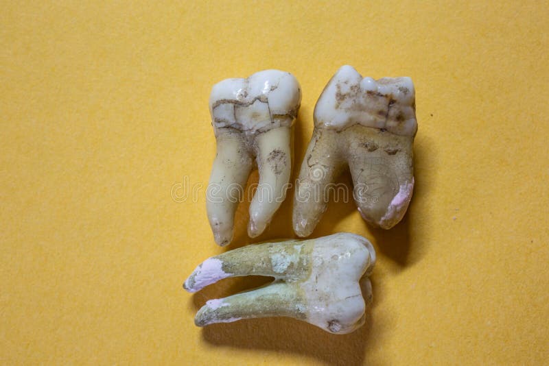 Human Molars with Tooth Roots Stock Image - Image of people, human ...
