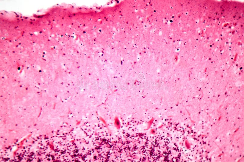 Human Motor Cortex, Photomicrograph Showing Pyramidal Neurons in ...