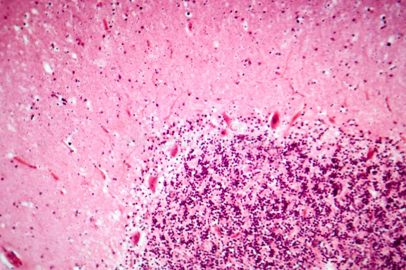 Human Motor Cortex, Photomicrograph Showing Pyramidal Neurons in ...