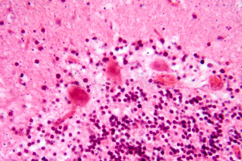 Human Motor Cortex, Photomicrograph Showing Pyramidal Neurons in ...