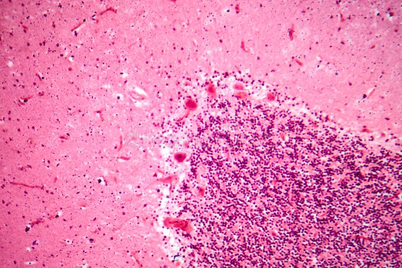 Human Motor Cortex, Photomicrograph Showing Pyramidal Neurons in ...