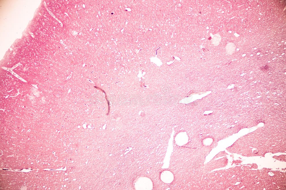 Human Nervous System Under the Microscope in Lab. Stock Image - Image ...