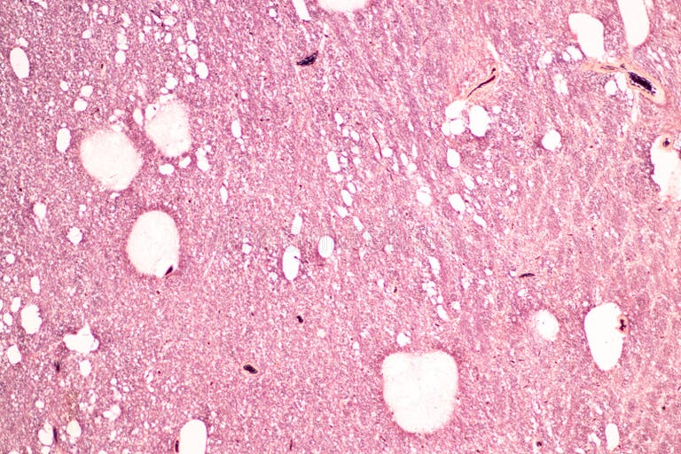 Human Nervous System Under the Microscope in Lab. Stock Photo - Image ...