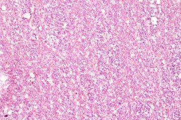 Human Brain Pyramidal Neuron Stock Photos - Free & Royalty-Free Stock ...