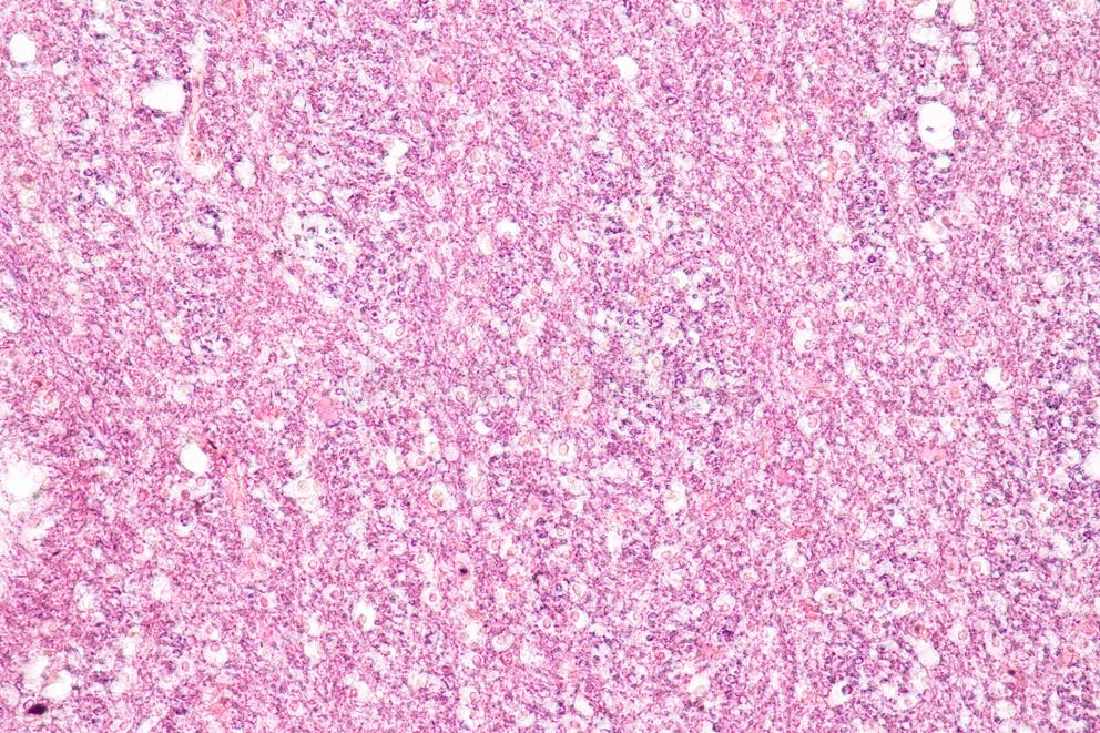 Human Nervous System Under the Microscope in Lab. Stock Photo - Image ...