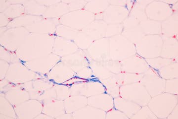 Human Brain Pyramidal Neuron Stock Photos - Free & Royalty-Free Stock ...