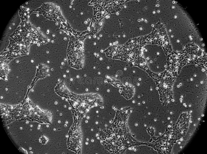 Human neural cell colonies stock photo. Image of brain - 26920624