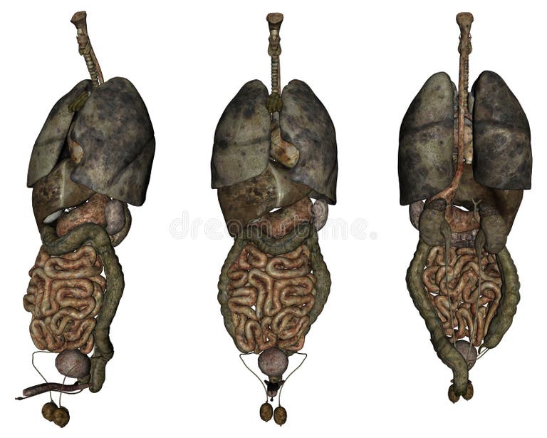 Sick Human Organs Stock Illustrations – 2,707 Sick Human Organs Stock ...