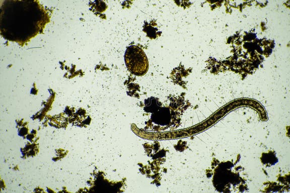 Human Parasites in the Human Gut Stock Image - Image of eating, move ...