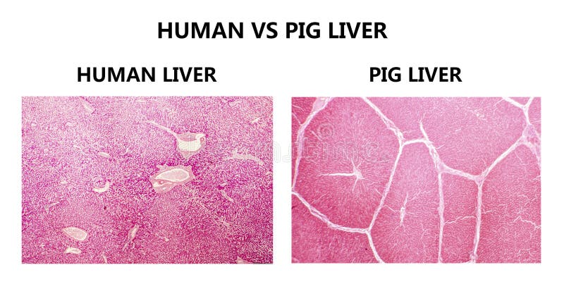Human and pig liver stock illustration. Illustration of background ... Human and pig liver stock illustration. Illustration of background ...