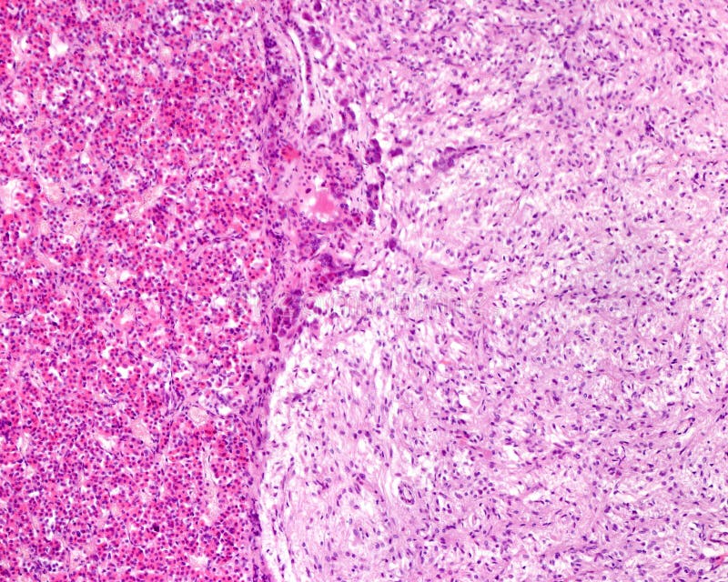 Human Pituitary. Intermediate Lobe Stock Photo - Image of intermediate ...