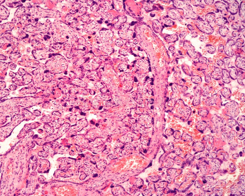 Human Placenta. Chorionic Villi Stock Photo - Image of embryo, placenta ...