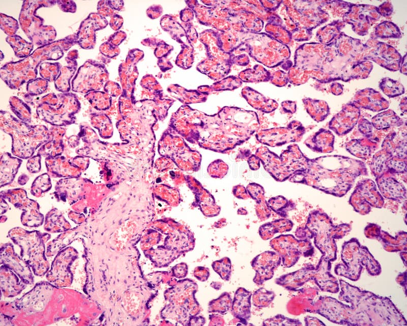 Human Placenta. Chorionic Villi Stock Image - Image of uterus ...
