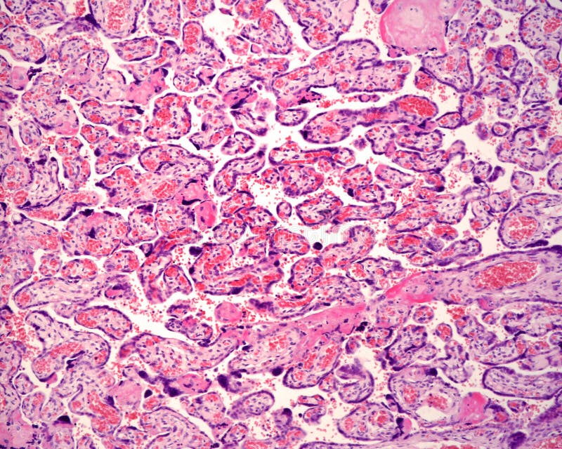 Human Placenta. Chorionic Villi Stock Photo - Image of tissue ...